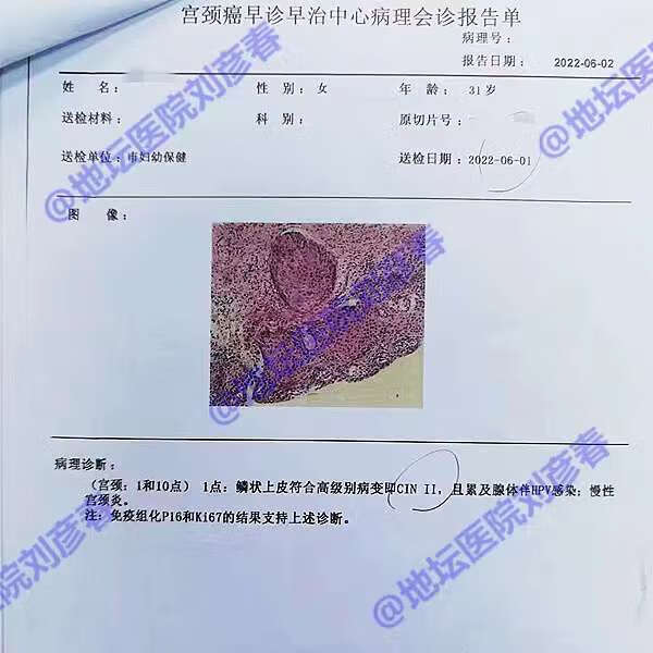 治疗后检查报告